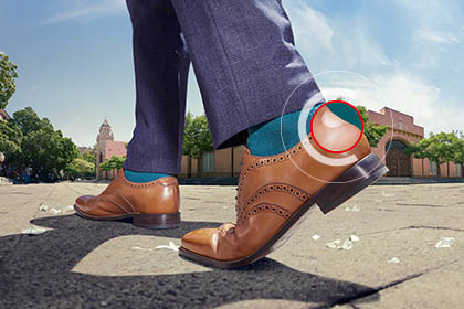 Gnagsår, munnsår, hallux valgus, liktorn og sprukken hæl | COMPEED®