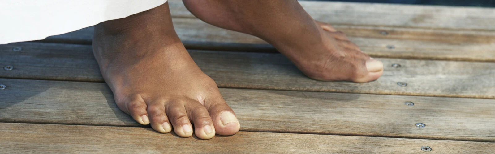 Hvordan kan man motvirke liktorn?